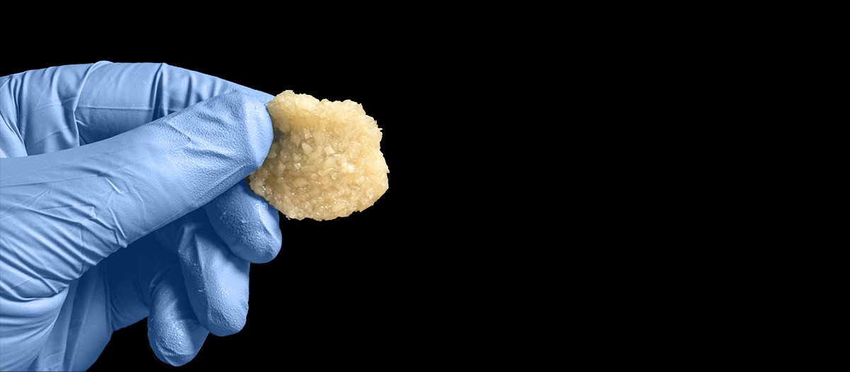 BEAST™ PLUS – Paragon 28