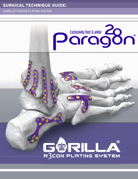 Gorilla® Universal T-Plates – Paragon 28