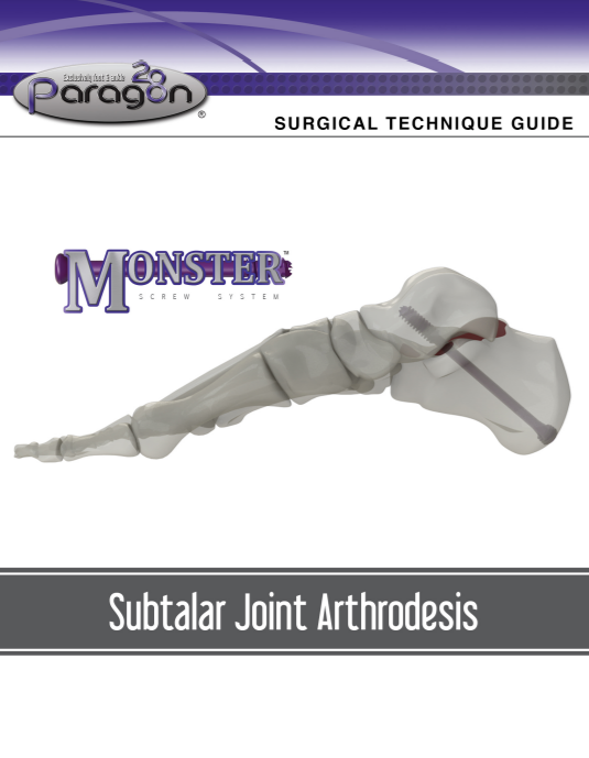 PRESERVE™ Subtalar Distraction Arthrodesis Graft – Paragon 28