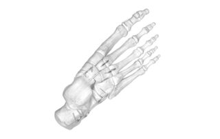 JAWS™ Nitinol Staple System – Paragon 28