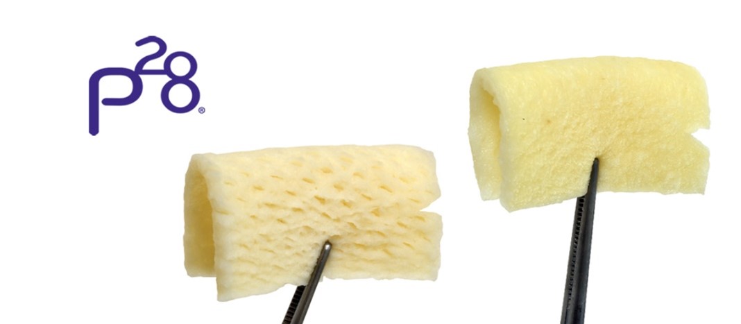 ParaDerm® Non-Fenestrated Dermal Matrix Launch – Paragon 28
