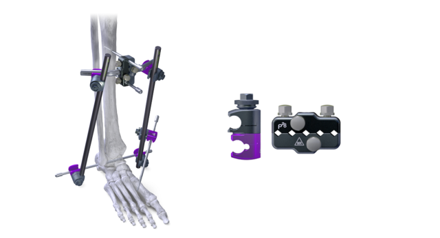 Monkey Bars™ Pin to Bar External Fixation System – Paragon 28