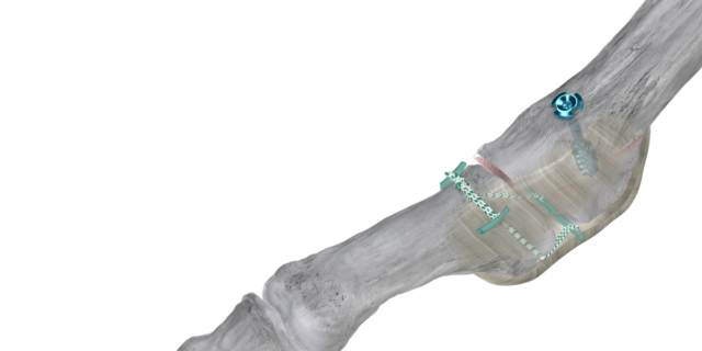 Paratrooper – Paragon 28