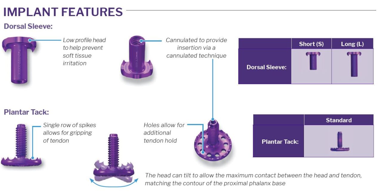 TenoTac® 2.0 Soft Tissue Fixation System – Paragon 28