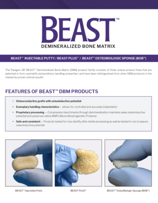 BEAST™ PLUS – Paragon 28