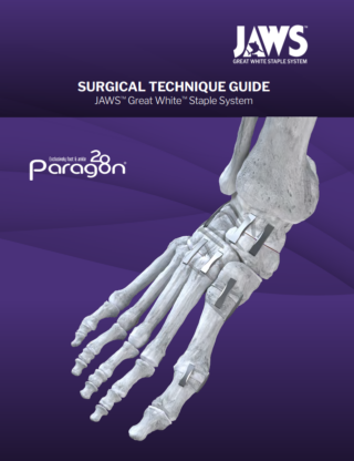 JAWS™ Great White Staple System – Paragon 28