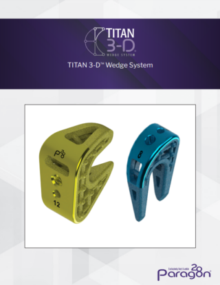 Product Brochures – Paragon 28