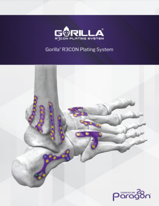 Product Brochures – Paragon 28