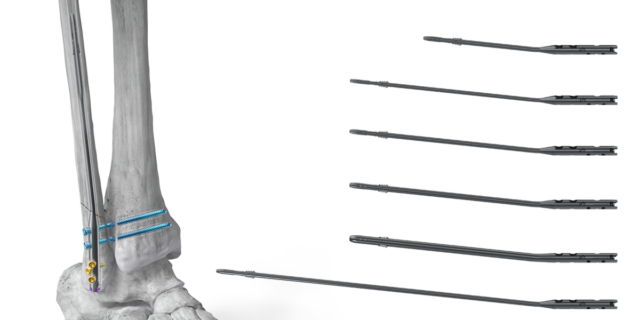 Phantom® Fibula Nail System – Paragon 28