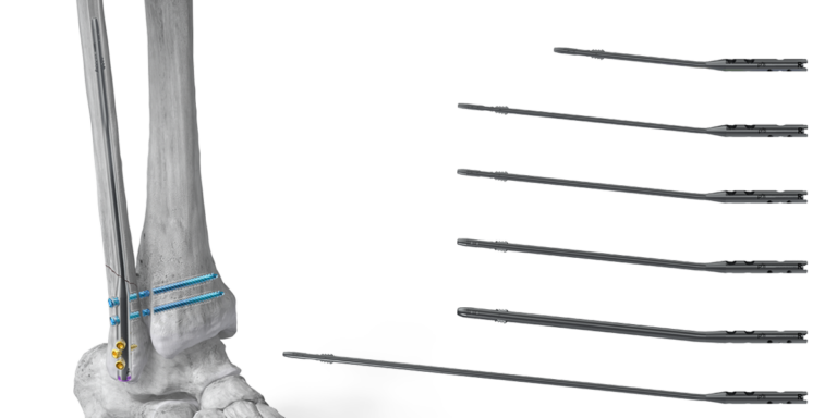Phantom® Fibula Nail System – Paragon 28
