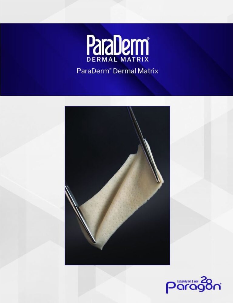 ParaDerm® Dermal Matrix – Paragon 28