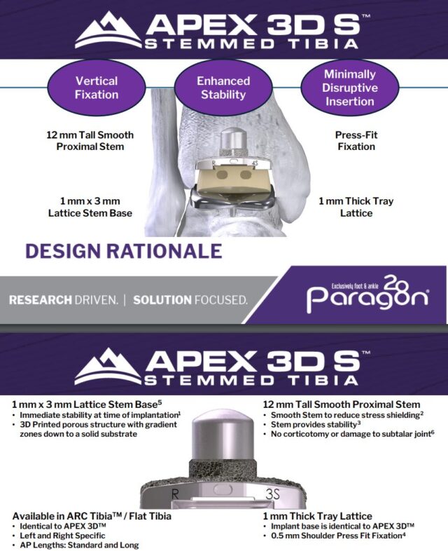 APEX 3D S™ Stemmed Tibia – Paragon 28