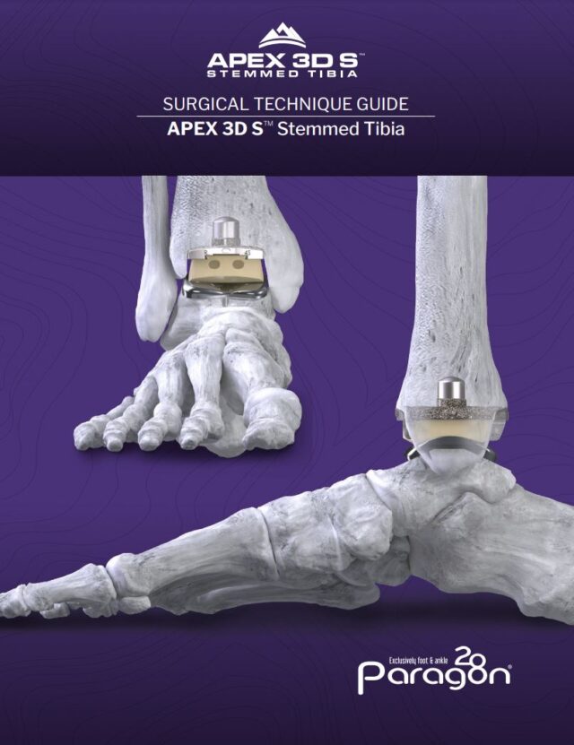 APEX 3D S™ Stemmed Tibia – Paragon 28