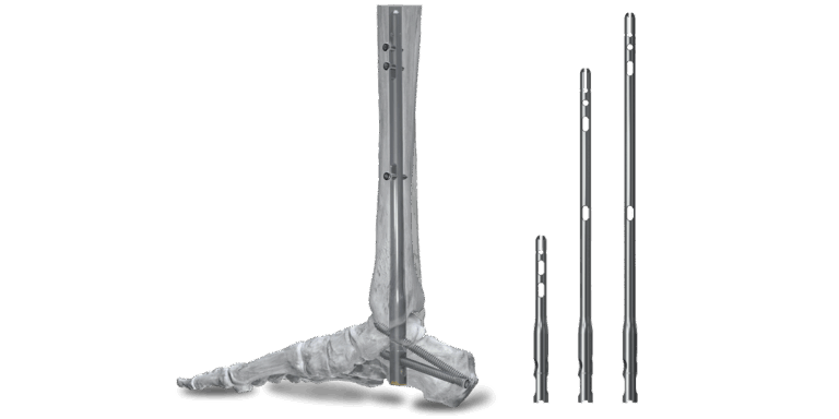 Phantom® TTC Trauma Nail – Paragon 28