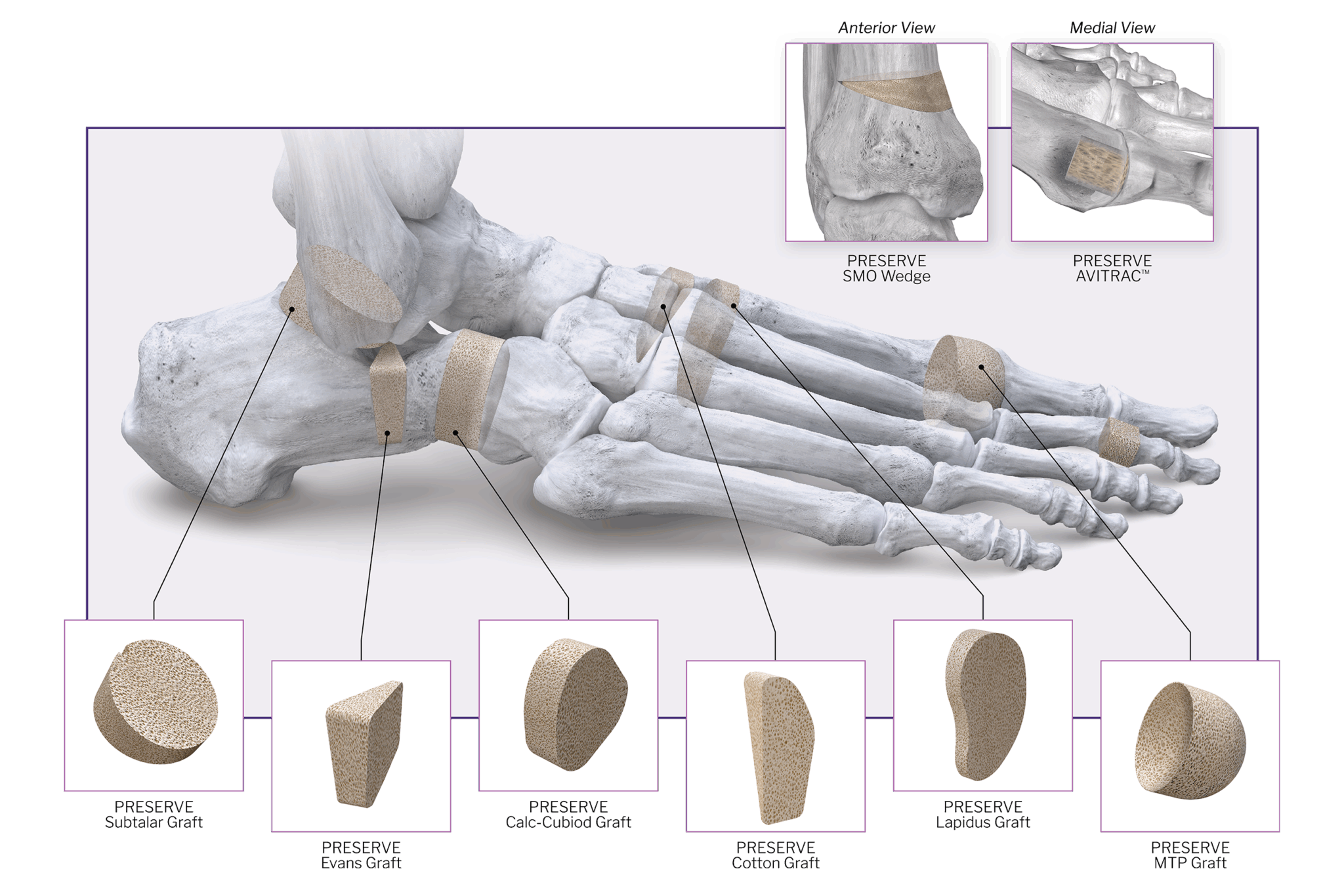 Paragon 28 – Paragon 28 Inc.