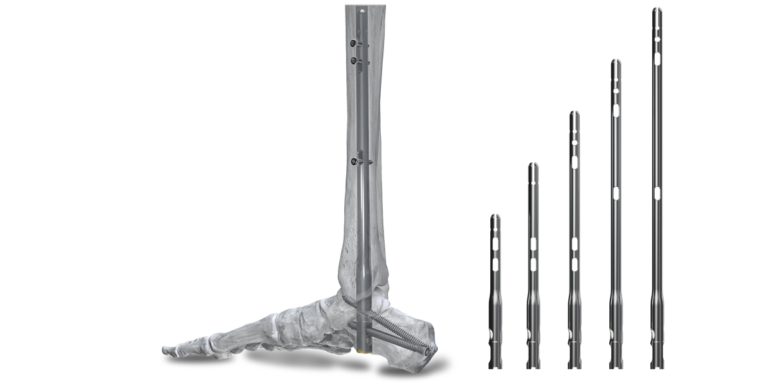 Phantom® TTC Trauma Nail – Paragon 28
