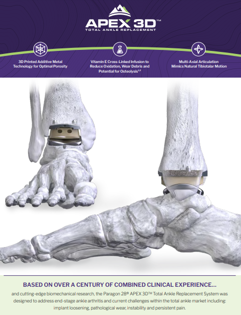 surgeon — APEX 3D™ Total Ankle Replacement System