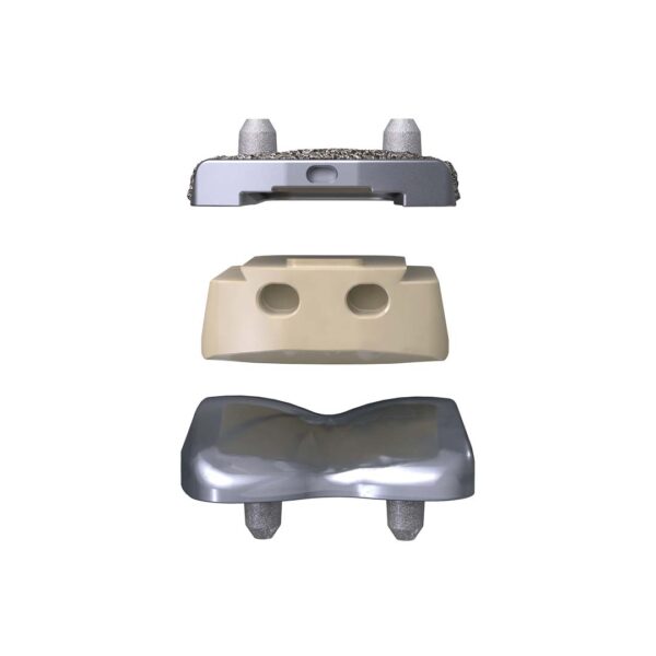 Total Ankle Replacement - Paragon 28