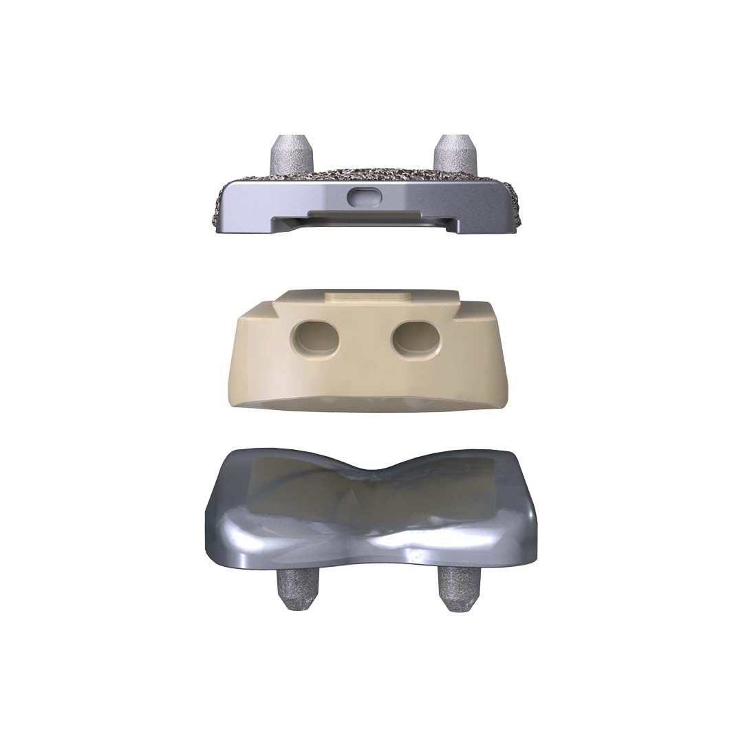Total Ankle Replacement Paragon 28