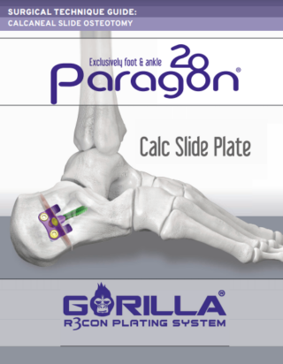 Gorilla® Calc Slide Plate - Paragon 28