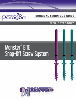 Monster® BITE Snap-Off Screw System - Paragon 28
