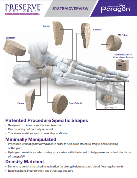 PRESERVE™ Calc-Cuboid Arthrodesis Length Restoring Graft - Paragon 28