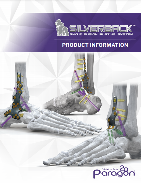 Silverback™ Ankle Fusion Plating System - Paragon 28