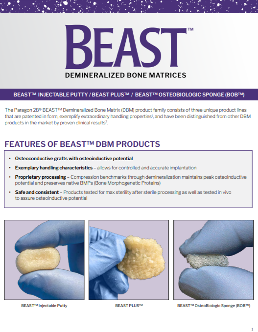 BEAST™ PLUS - Paragon 28