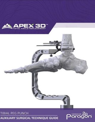 Surgical Technical Guides | Paragon 28