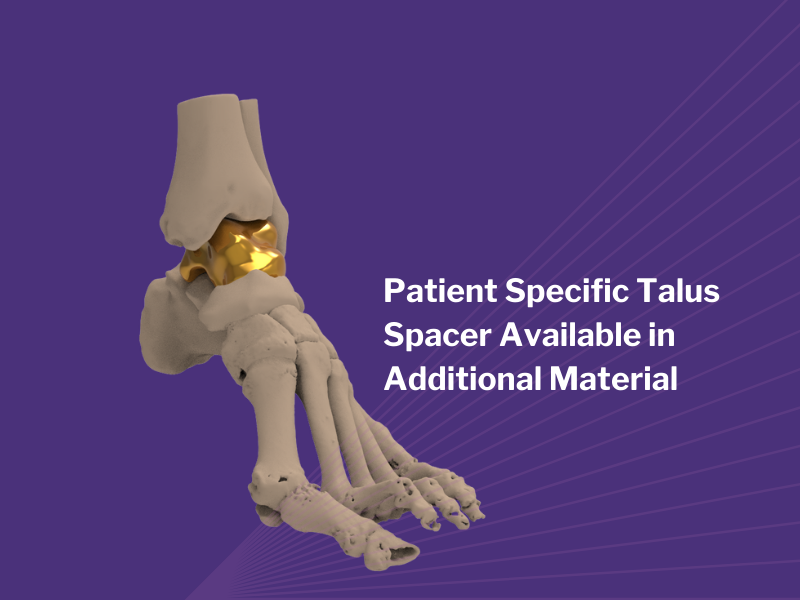 Patient Specific Titanium Talus Spacer Approved by FDA - Paragon 28