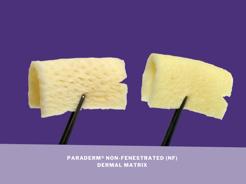 ParaDerm® Non-Fenestrated Dermal Matrix Launch - Paragon 28