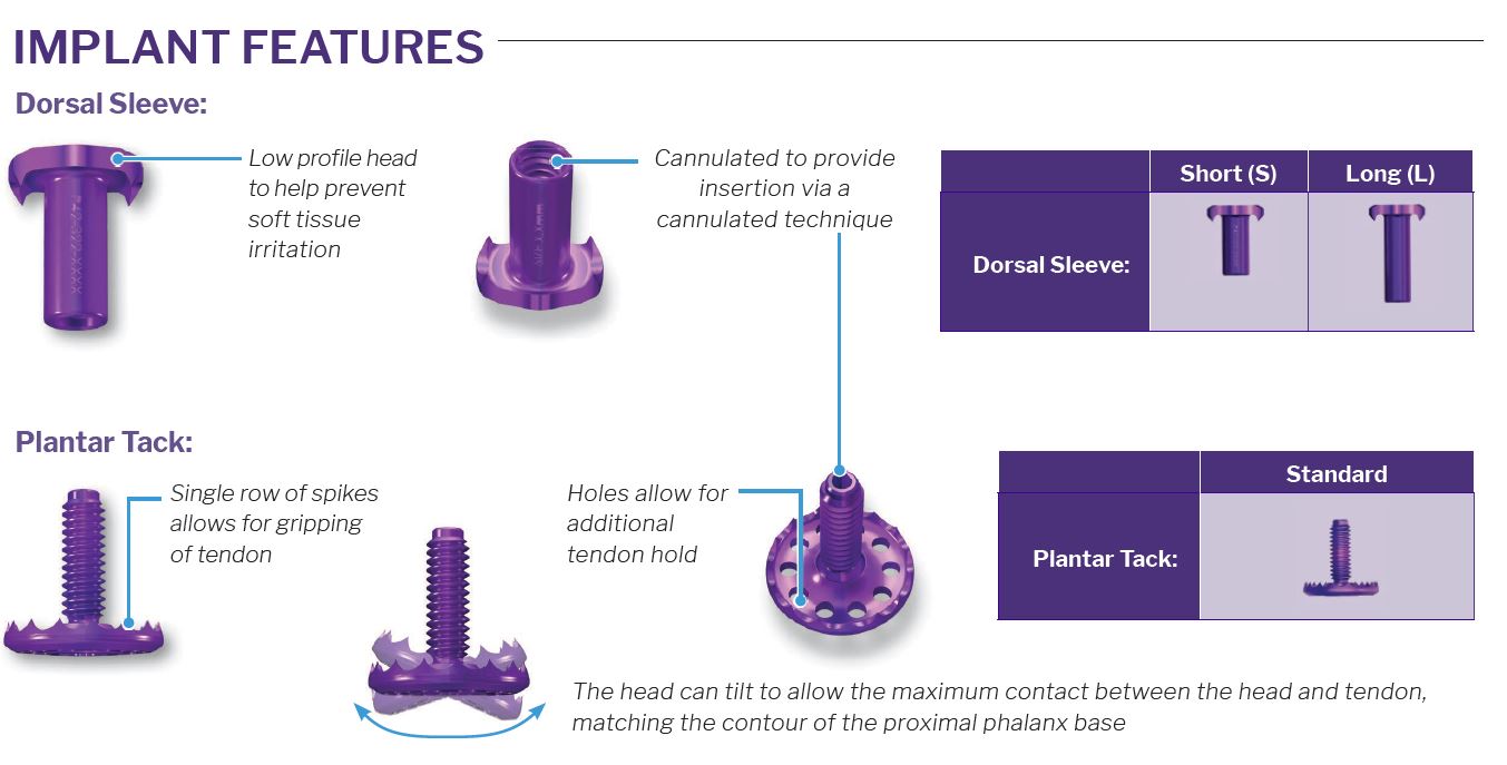 TenoTac® 2.0 Soft Tissue Fixation System - Paragon 28