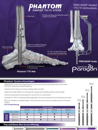 Phantom® Hindfoot TTC/TC System – Paragon 28